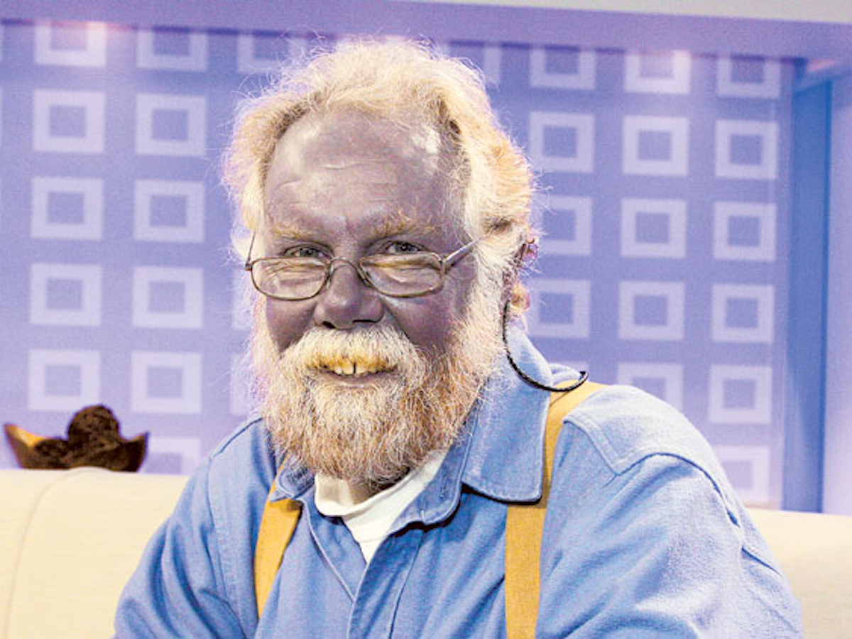 Unpredictable Genetics: The Record-Breaking Strangest Humans on Earth
